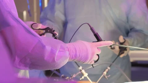 Laparoscopic Cholecystectomy Stock Videos – Royalty-Free HD & 4K Videos