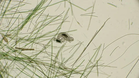 a large and small water bear Tardigrada,... | Stock Video | Pond5