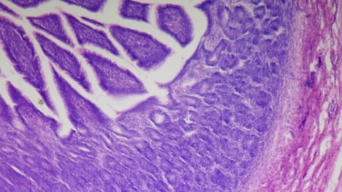 Large intestine (Colon) under microscope... | Stock Video | Pond5