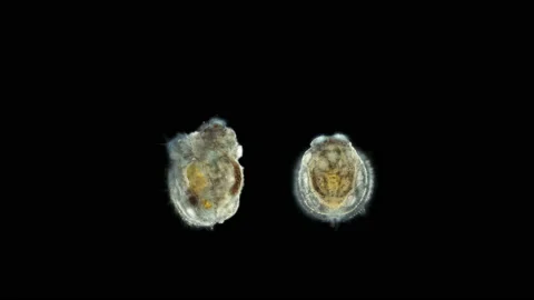 larva Kamptozoa under the microscope, ty... | Stock Video | Pond5