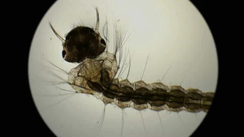 larva of a mosquito under a microscope | Stock Video | Pond5