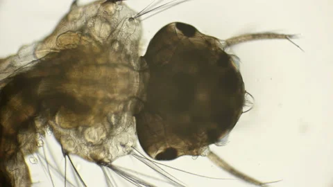 larva of a mosquito under a microscope | Stock Video | Pond5