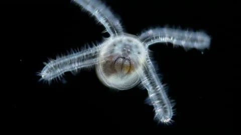 Larva sea snail under a microscope, call... | Stock Video | Pond5
