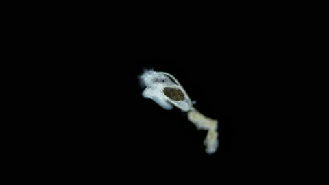Larva sea snail under a microscope, call... | Stock Video | Pond5