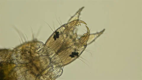 larvae of the beetle Hydrophilidae under... | Stock Video | Pond5