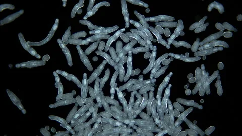 Larvae of parasitic worm Podocotyle sp. ... | Stock Video | Pond5