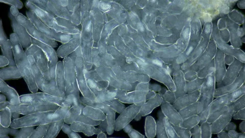 Larvae of parasitic worm Podocotyle sp. ... | Stock Video | Pond5