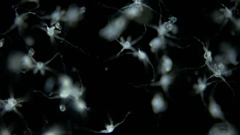 Larvae of sea spider Phoxichilidium femo... | Stock Video | Pond5
