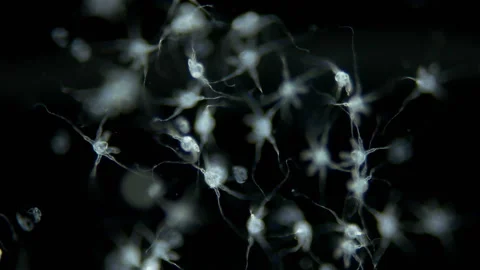 Larvae of sea spider Phoxichilidium femo... | Stock Video | Pond5