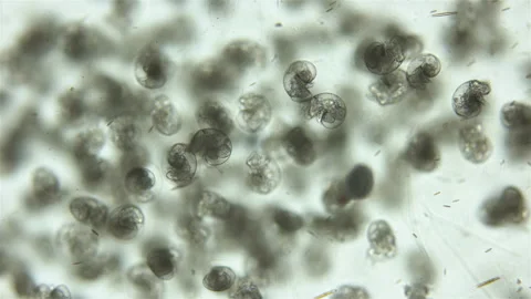 Larvae veliger Mollusca in a clutch of e... | Stock Video | Pond5