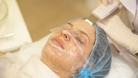 Laser removal of black dots from the ski... | Stock Video | Pond5