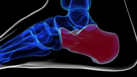 Lateral view of calcaneus bone foot bone... | Stock Video | Pond5