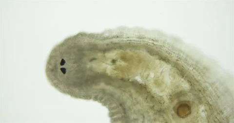 Leech Stock Videos – Royalty-Free HD & 4K Videos | Pond5