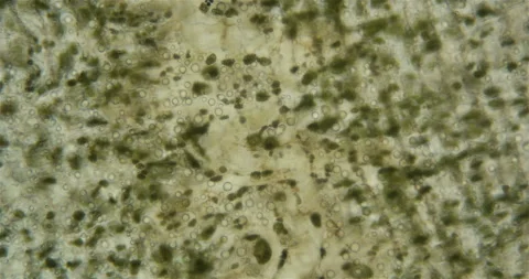 Leech Stock Videos – Royalty-Free HD & 4K Videos | Pond5