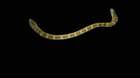 Leech. Fish leech Piscicola under the mi... | Stock Video | Pond5