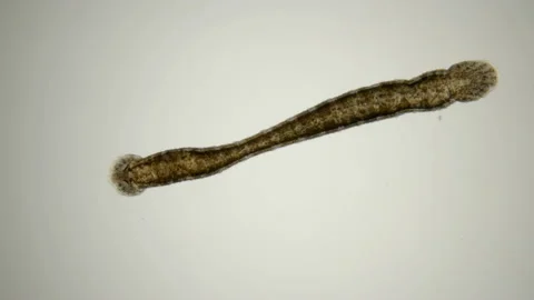 Leech Stock Videos – Royalty-Free HD & 4K Videos | Pond5