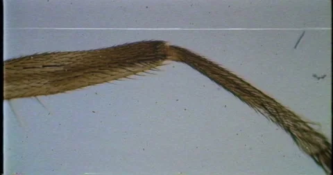Leg of fly under a microscope. Documenta... | Stock Video | Pond5