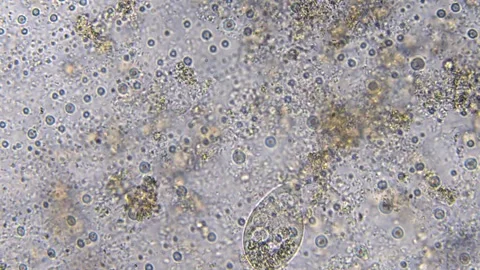 Life in a water droplet under a microsco... | Stock Video | Pond5