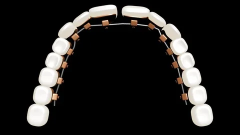 Braces Model Stock Footage ~ Royalty Free Stock Videos | Pond5