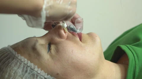 Lip injection procedure. Plastic surgery... | Stock Video | Pond5