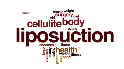 Liposuction animated word cloud, text de... | Stock Video | Pond5