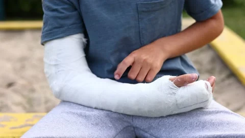 Child Broken Arm Stock Footage ~ Royalty Free Stock Videos | Pond5
