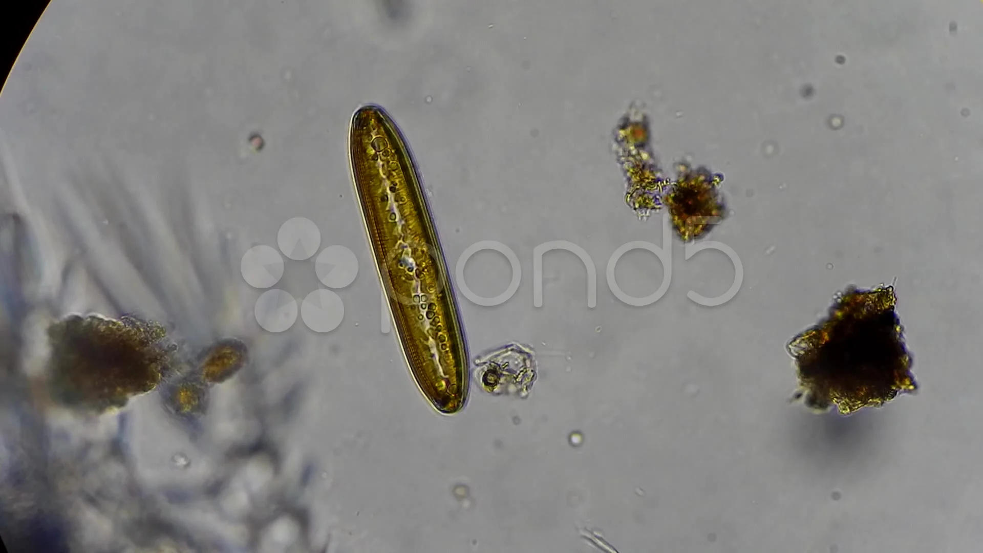 Stentor Under Microscope 400x