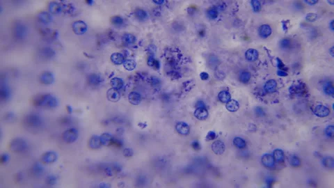 The liver under the microscope. Vitamin ... | Stock Video | Pond5