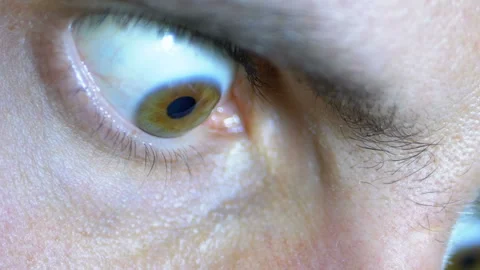 Look of Fear, Bulging Eyes of a Young Ma... | Stock Video | Pond5