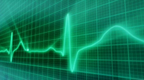 loopable background EKG electrocardiogra... | Stock Video | Pond5