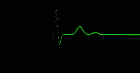 Loopable: EKG Line / EKG Monitor / EKG M... | Stock Video | Pond5