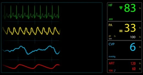 Vital Signs Monitor Displays Ekg Heart Rate Oxygen