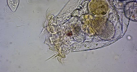 Loricate rotifer closeup corona feeding ... | Stock Video | Pond5