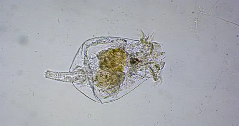 Loricate rotifer in slow motion showing ... | Stock Video | Pond5