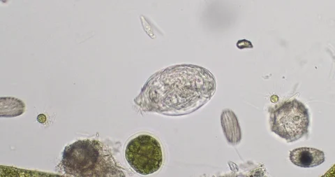 Rotifera Stock Footage ~ Royalty Free Stock Videos | Pond5