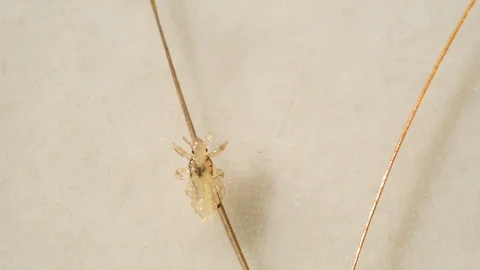 Louse isolated on a white background mov... | Stock Video | Pond5