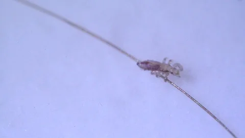 Louse isolated on a white background mov... | Stock Video | Pond5