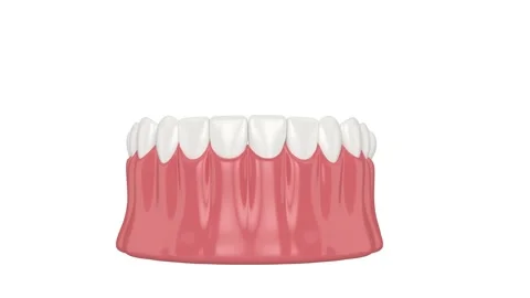 Lower jaw with cast post and core inciso... | Stock Video | Pond5