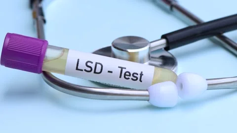 LSD test to look for abnormalities from ... | Stock Video | Pond5