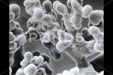 Lung alveolus, sem Alveoli are tiny cavities clustered together to form ...