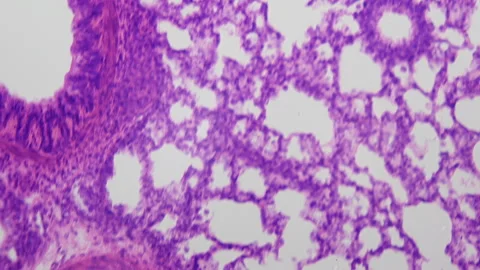 Lungs. 100x magnification. Microanatomy.... | Stock Video | Pond5