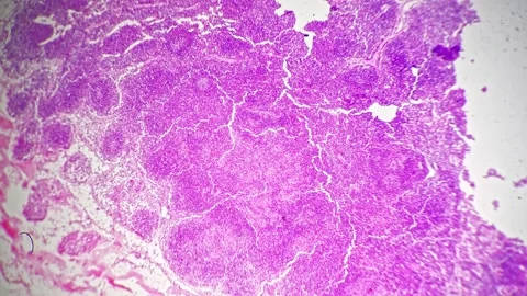 Lymph node in section filmed under micro... | Stock Video | Pond5