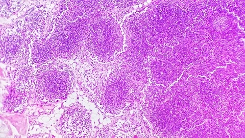 Lymph node in section filmed under micro... | Stock Video | Pond5