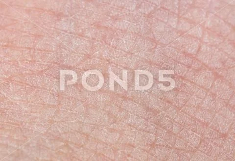 Macro Photo of Texture of Human Skin Stock Image #103013146