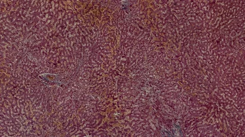 Macro shot of a human liver cells under ... | Stock Video | Pond5