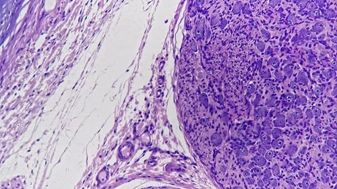 Macro slide of bone cell in section unde... | Stock Video | Pond5