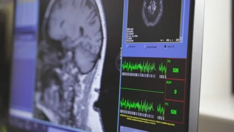 Magnetic resonance imaging, the screen s... | Stock Video | Pond5