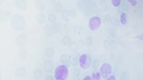 Magnified View of Stained Blood Cells Un... | Stock Video | Pond5