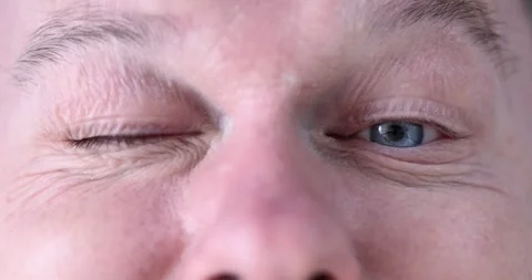 Eye Wink Of Eyes Stock Video Footage | Royalty Free Eye Wink Of Eyes ...