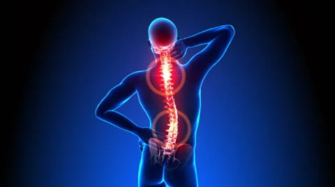Back Pain Stock Footage ~ Royalty Free Stock Videos | Pond5